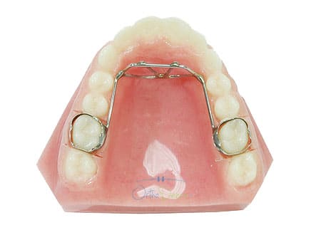 Digital Orthodontic Appliances | OrthoDenco Orthodontic Lab