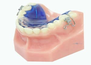 Dental Clasps | OrthoDenco Orthodontic Lab