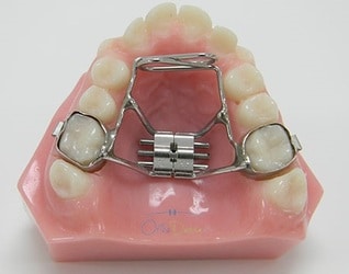 Arch Developments | OrthoDenco Orthodontic Lab