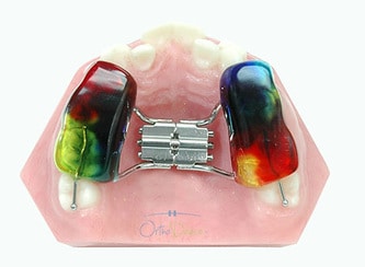 Arch Developments | OrthoDenco Orthodontic Lab