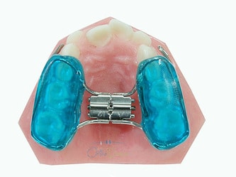 Arch Developments | OrthoDenco Orthodontic Lab