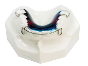 Labial Bows | OrthoDenco Orthodontic Lab