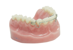 Labial Bows | OrthoDenco Orthodontic Lab