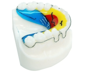 Labial Bows | OrthoDenco Orthodontic Lab
