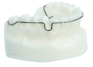 Labial Bows | OrthoDenco Orthodontic Lab
