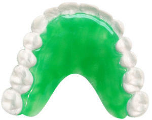 Palatal Acrylic | OrthoDenco Orthodontic Lab