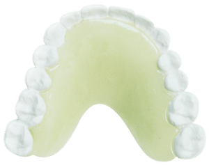 Palatal Acrylic | OrthoDenco Orthodontic Lab