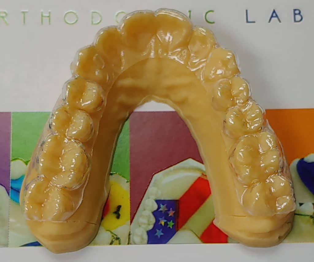 Get Clear Vacuum Retainers FAST - OrthoDenco Orthodontic Lab