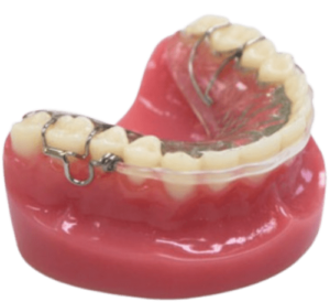 Orthodontic Retainers | OrthoDenco Orthodontic Lab