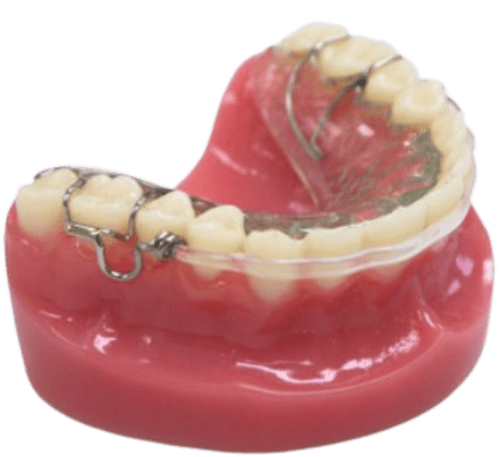 Orthodontic Retainers | OrthoDenco Orthodontic Lab